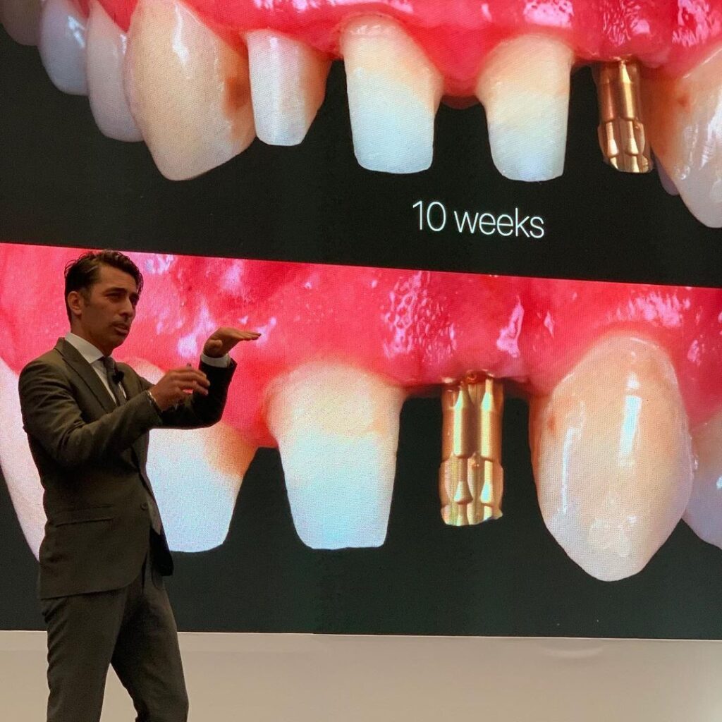 11 En İyi İstanbul Diş Kliniği ve Hekimi